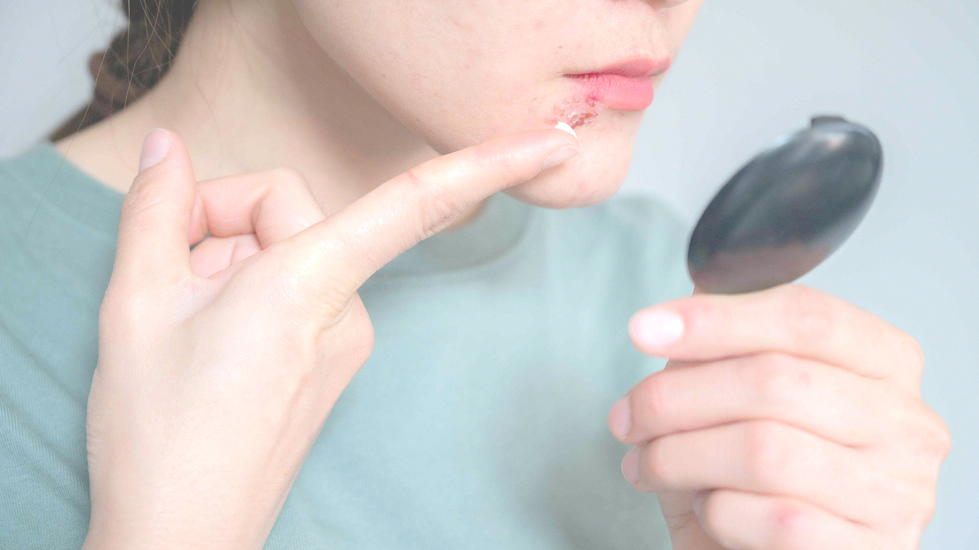 Príznaky a symptómy oparu na perách | Zdravie 365